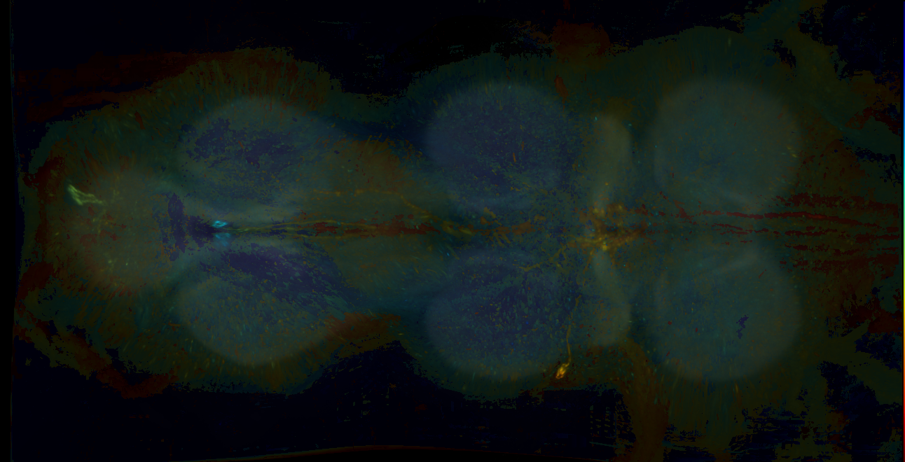 P{GMR40D06-GAL4} expression pattern [VFBexp_FBtp0060019] | Virtual Fly Brain